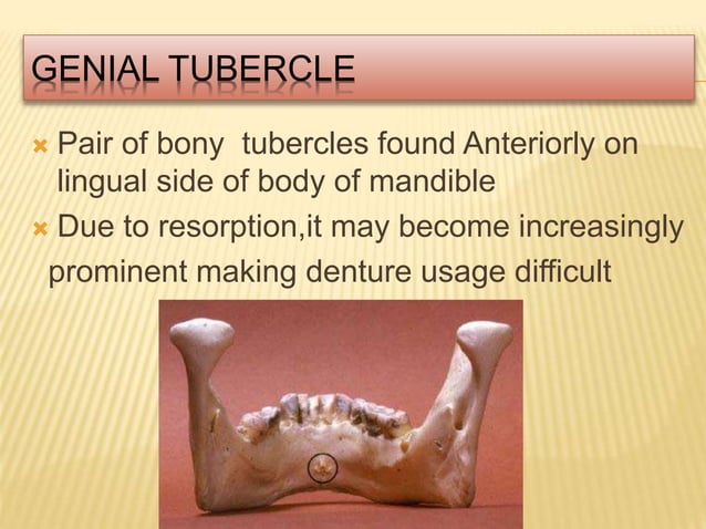 Anatomical Landmarks of Mandible | PPTX | Dental Health | Diseases and ...