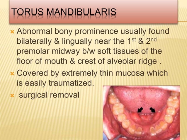 Anatomical Landmarks of Mandible | PPTX | Dental Health | Diseases and ...