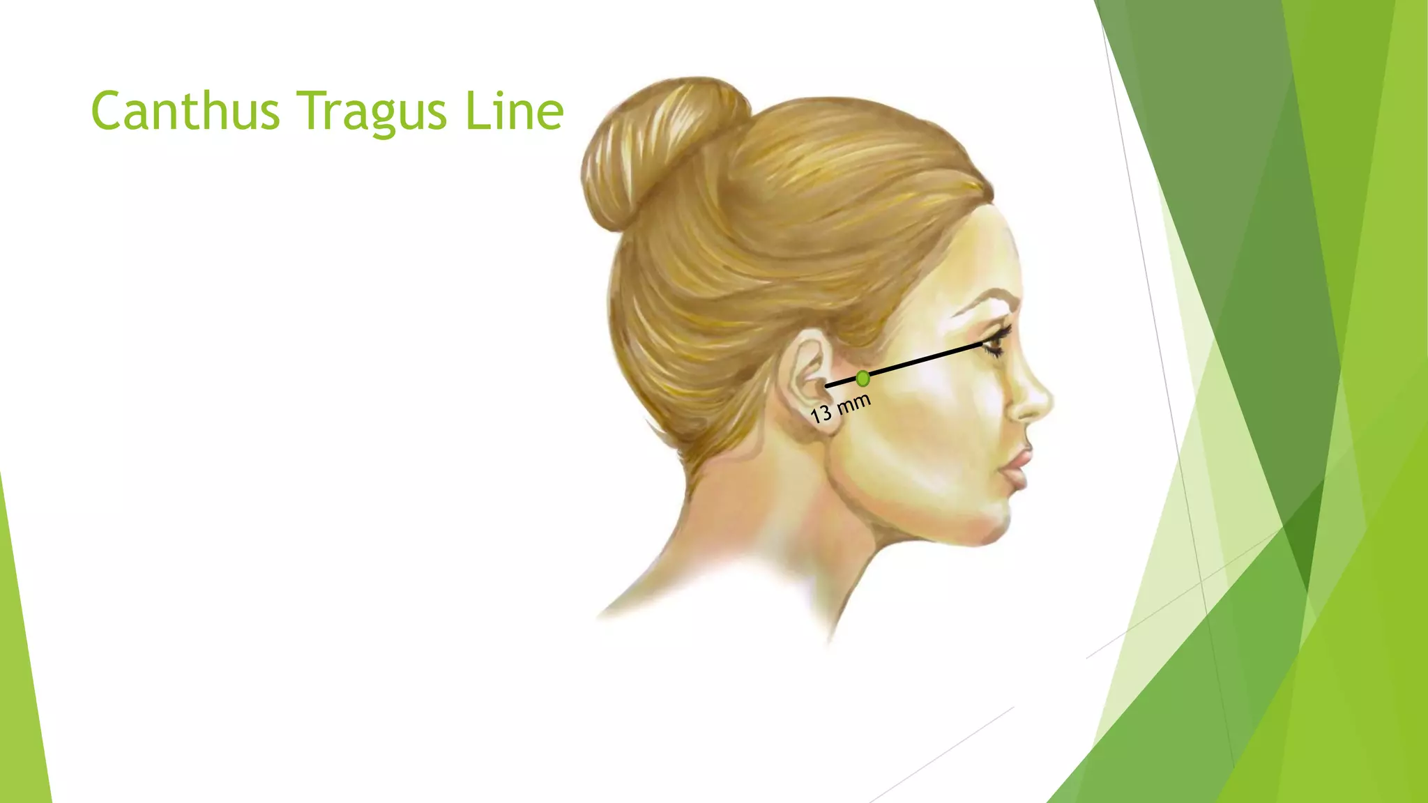 Anatomical landmarks for edentulous patients and facial landmarks | PPTX