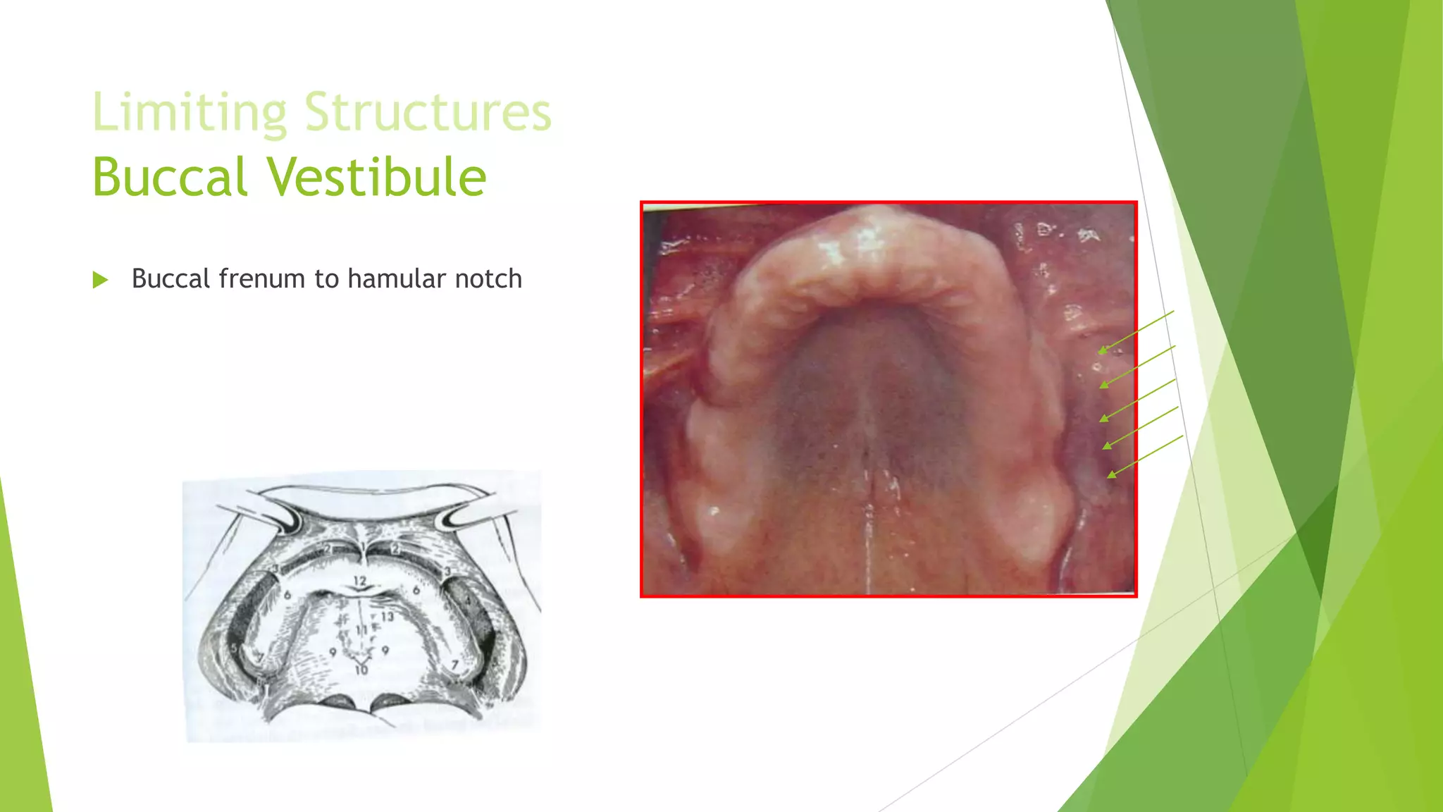 Anatomical landmarks for edentulous patients and facial landmarks | PPTX