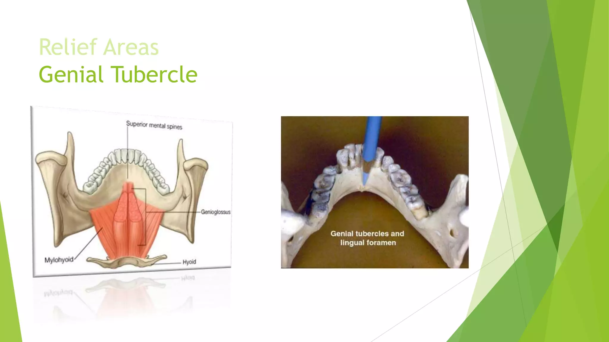 Anatomical landmarks for edentulous patients and facial landmarks | PPTX