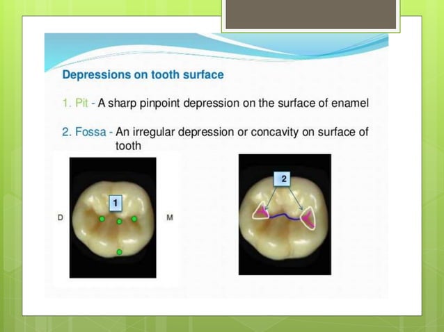 Anatomical land marks of a tooth | PPTX | Dental Health | Diseases and ...