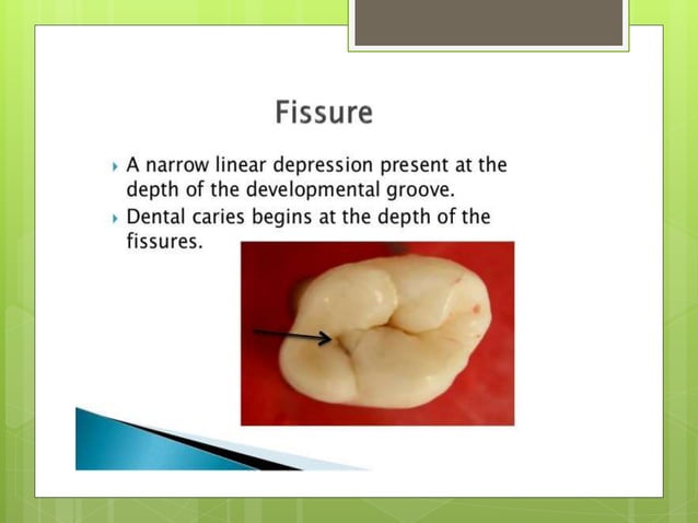 Anatomical land marks of a tooth | PPTX | Dental Health | Diseases and ...