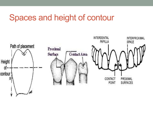 Anatomical land marks of a tooth | PPTX | Dental Health | Diseases and ...
