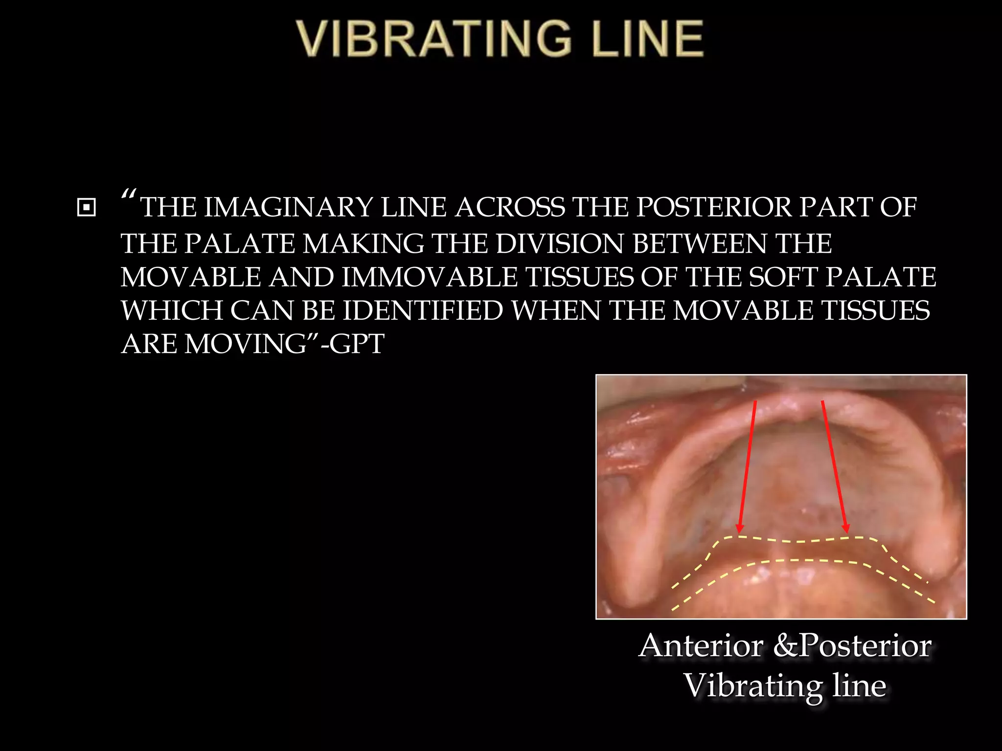 Anatomical landmarks of denture bearing area of.pptx final | PPTX