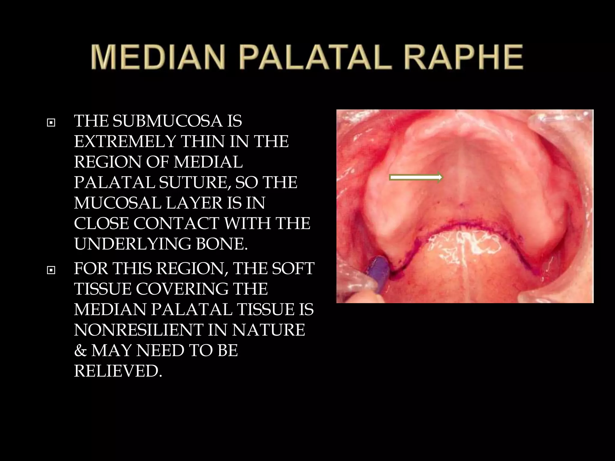 Anatomical landmarks of denture bearing area of.pptx final | PPTX