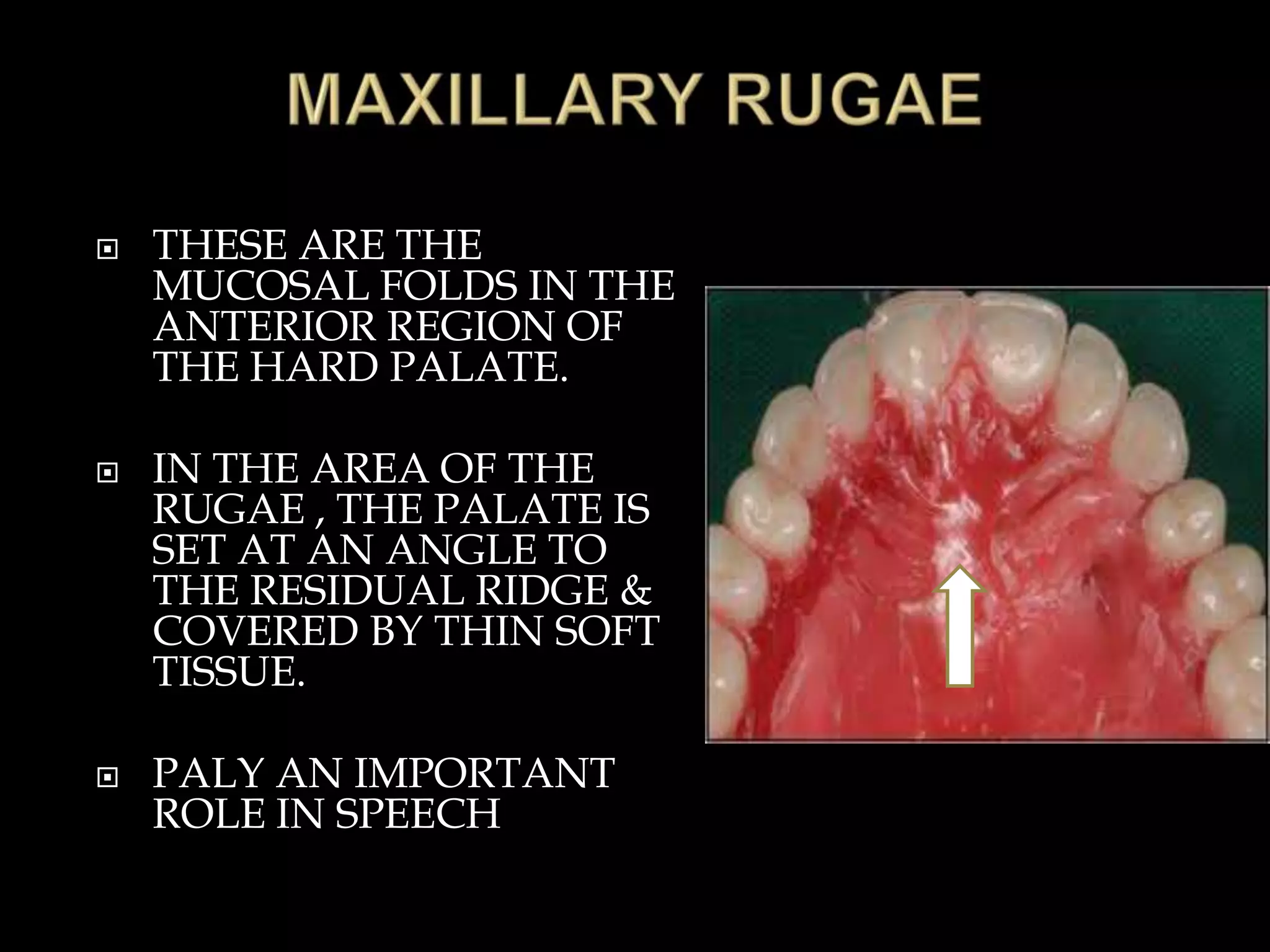 Anatomical landmarks of denture bearing area of.pptx final | PPTX