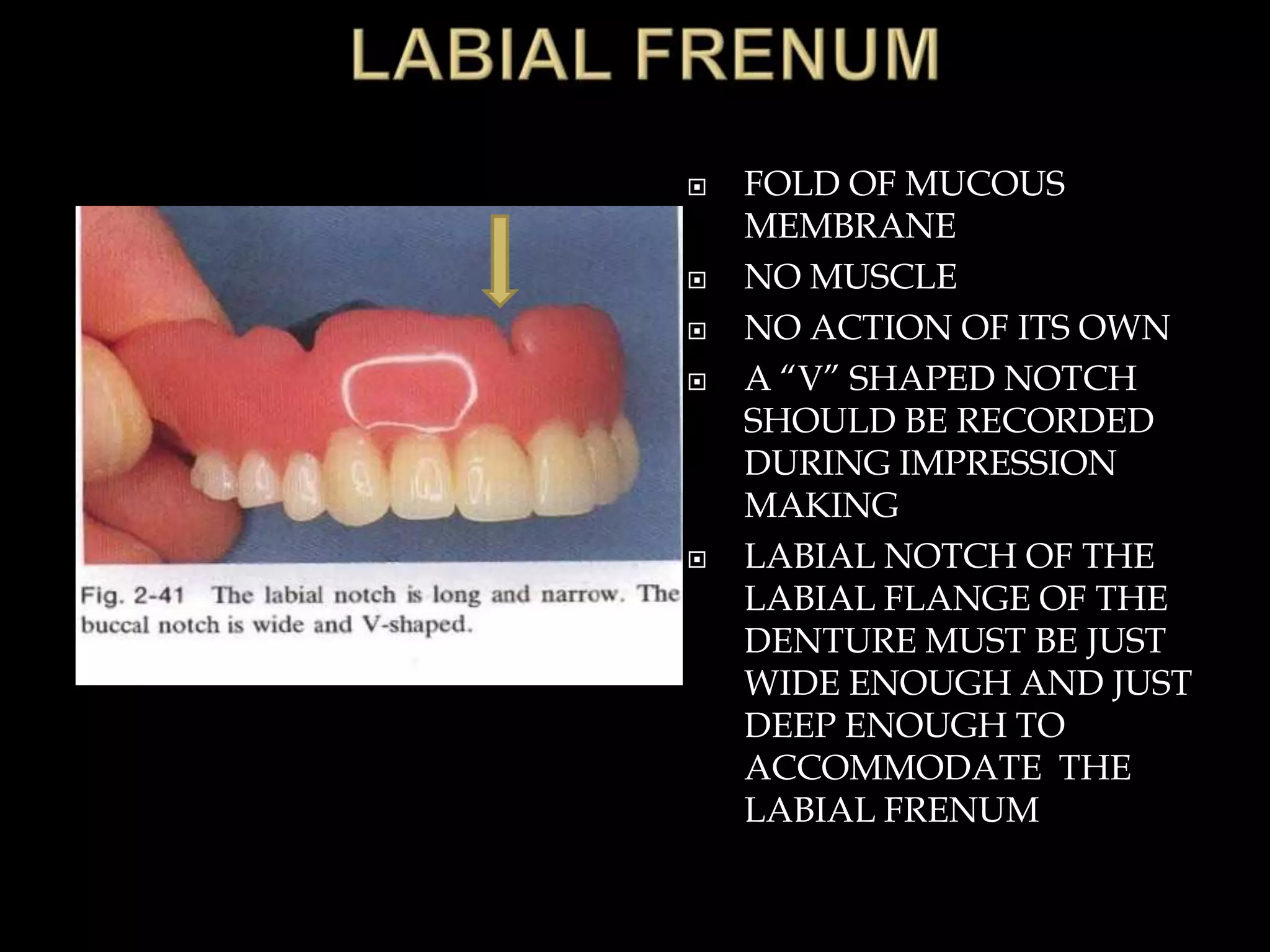 Anatomical landmarks of denture bearing area of.pptx final | PPTX