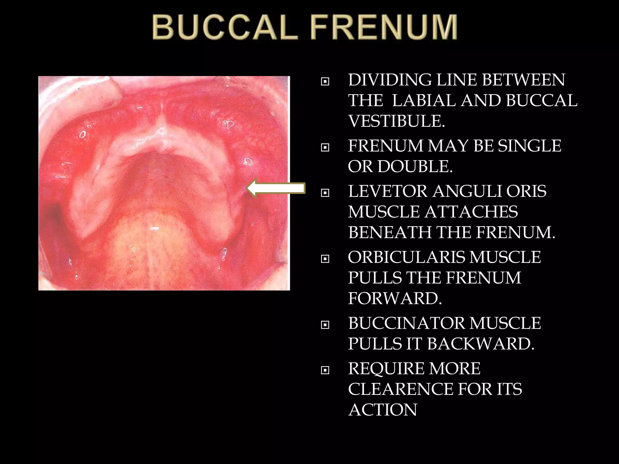 Anatomical landmarks of denture bearing area of.pptx final | PPTX
