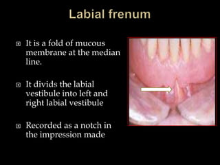 Anatomical landmarks of denture bearing area of.pptx final | PPTX