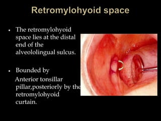 Anatomical landmarks of denture bearing area of.pptx final | PPTX
