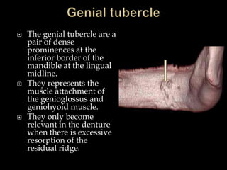 Anatomical landmarks of denture bearing area of.pptx final | PPTX
