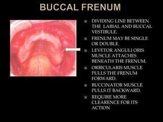 Anatomical landmarks of denture bearing area of.pptx final | PPTX