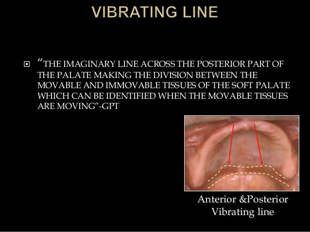 Anatomical landmarks of denture bearing area of.pptx final