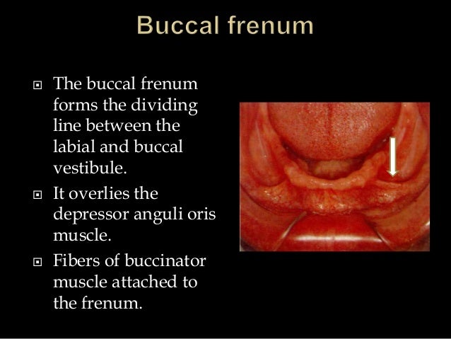 Anatomical landmarks of denture bearing area of.pptx final