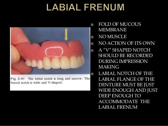 Maxillary Landmarks Labial Frenum Incisive Papilla