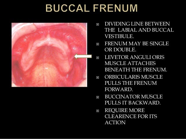 Anatomical landmarks of denture bearing area of.pptx final