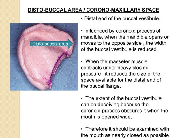ANATOMICAL LANDMARKS OF EDENTULOUS MOUTH IN COMPLETE DENTURE.pptx | Ear ...