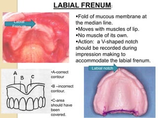ANATOMICAL LANDMARKS OF EDENTULOUS MOUTH IN COMPLETE DENTURE.pptx