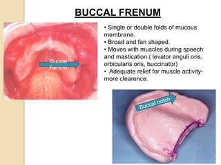 ANATOMICAL LANDMARKS OF EDENTULOUS MOUTH IN COMPLETE DENTURE.pptx