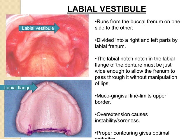ANATOMICAL LANDMARKS OF EDENTULOUS MOUTH IN COMPLETE DENTURE.pptx | Ear ...