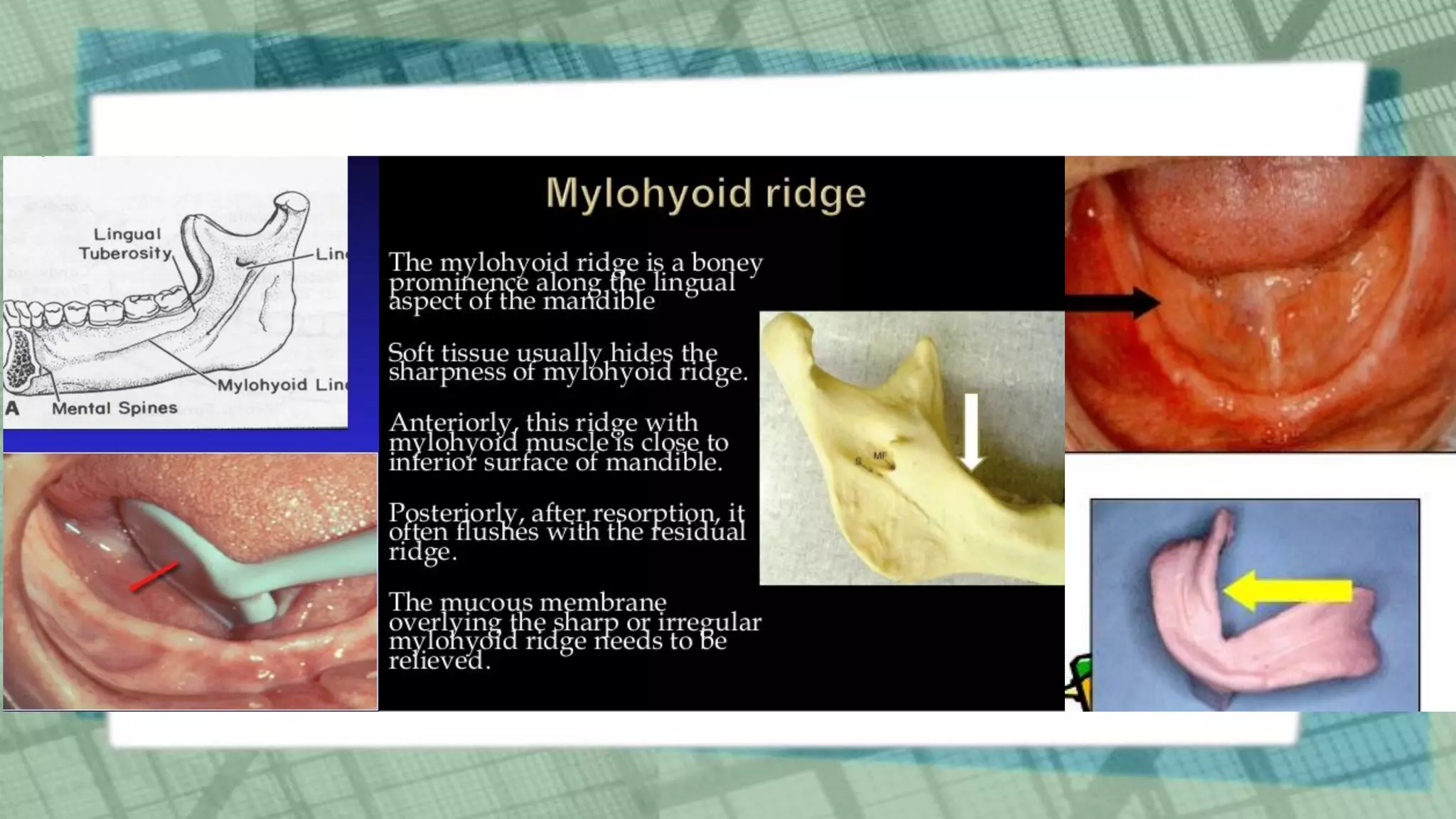Anatomical landmarks of mandible | PDF