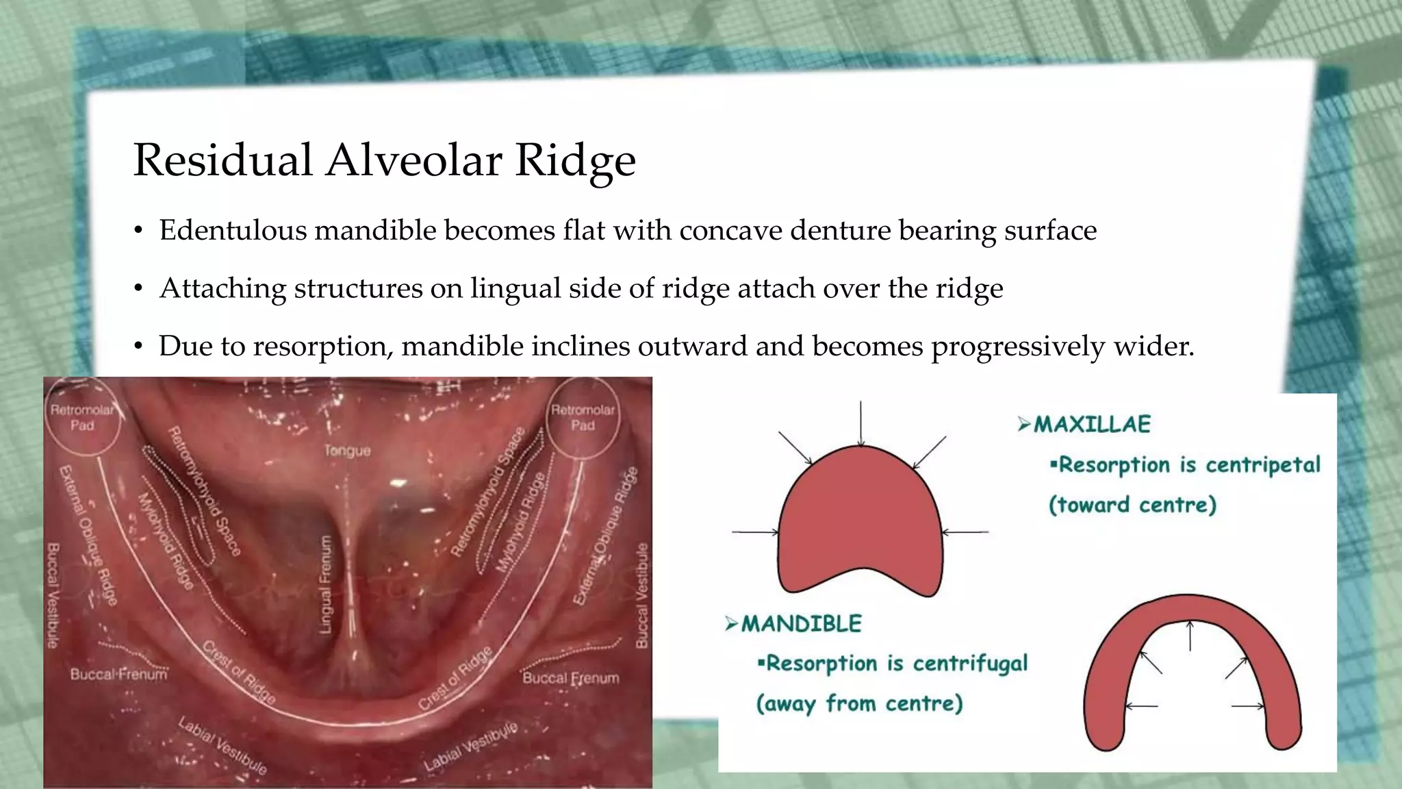 Anatomical landmarks of mandible | PDF