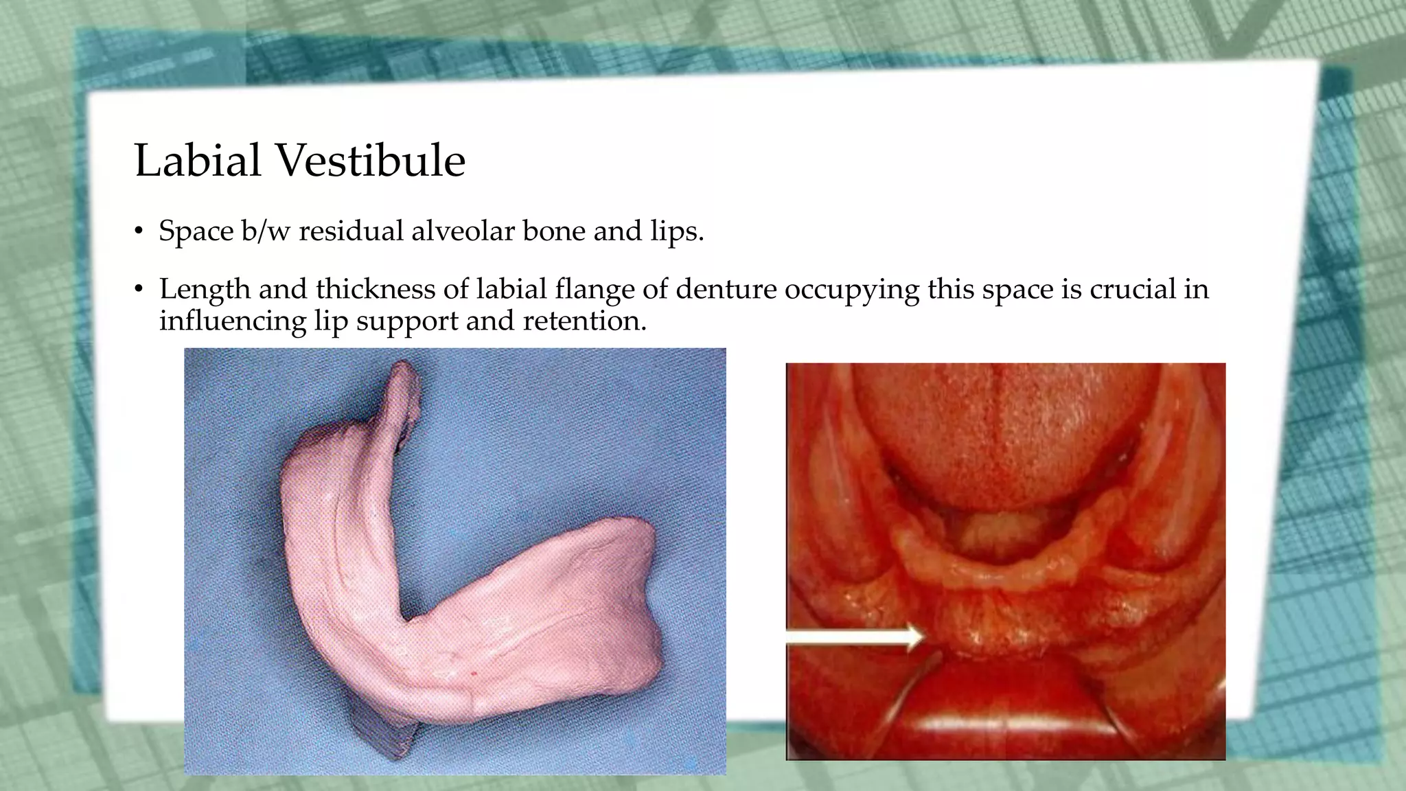 Anatomical landmarks of mandible | PDF
