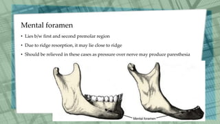 Anatomical landmarks of mandible | PDF