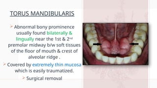ANATOMICAL LANDMARKS OF MANDIBLE prostho-1.pptx
