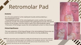 Anatomical Landmarks of Mandibular Arch..pptx