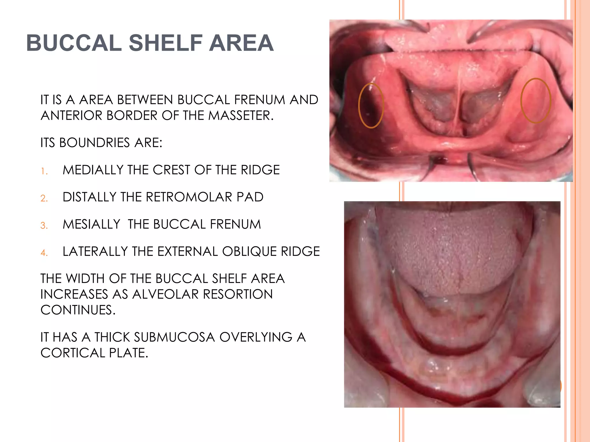 Anatomical landmarks of mandibule | PPTX