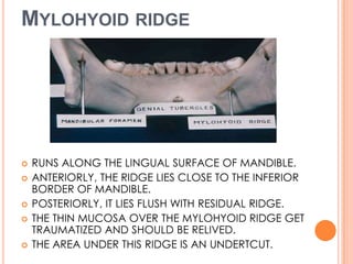 Anatomical landmarks of mandibule | PPTX