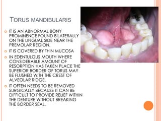 Anatomical landmarks of mandibule | PPTX