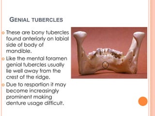 Genial Tubercle