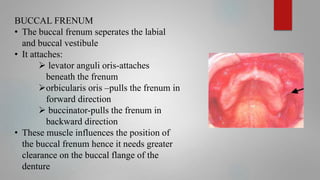 Anatomical landmarks of maxila | PPTX