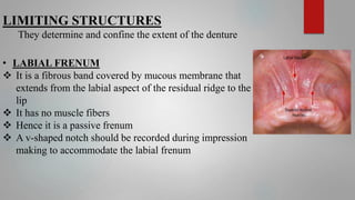 Anatomical landmarks of maxila | PPTX