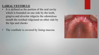 Anatomical landmarks of maxila | PPTX