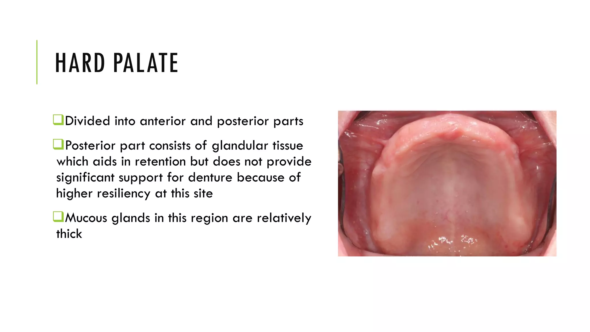 Anatomical landmarks of maxilla | PDF