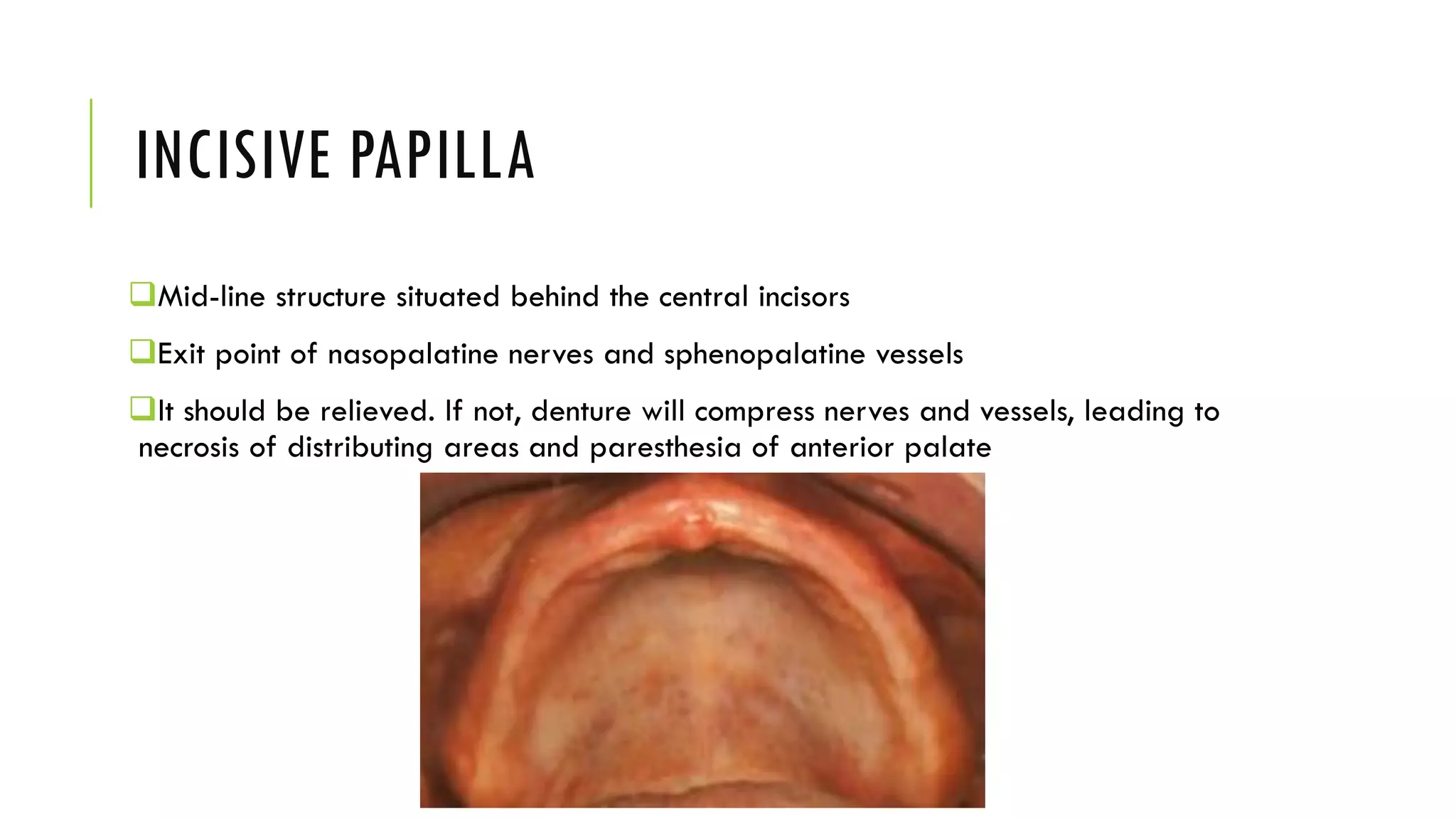 Anatomical landmarks of maxilla | PDF