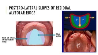 Anatomical landmarks of maxilla | PDF