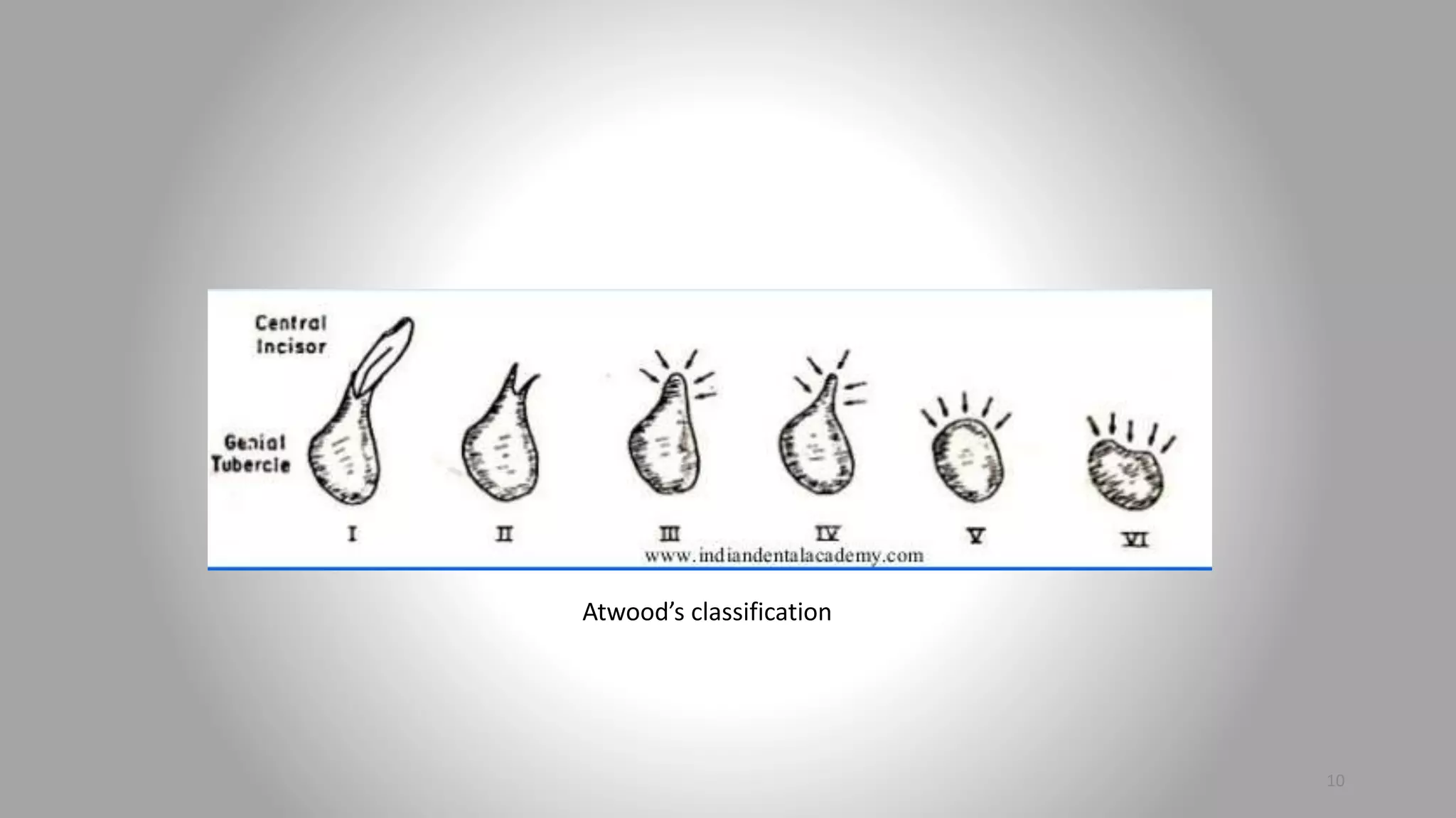 Anatomical landmarks of maxilla | PPTX