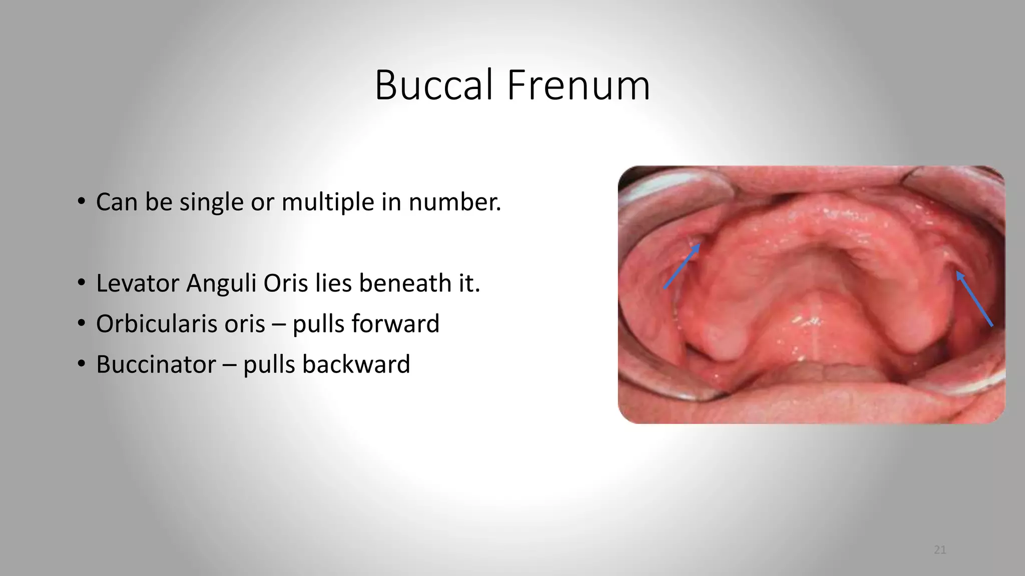 Anatomical landmarks of maxilla | PPTX