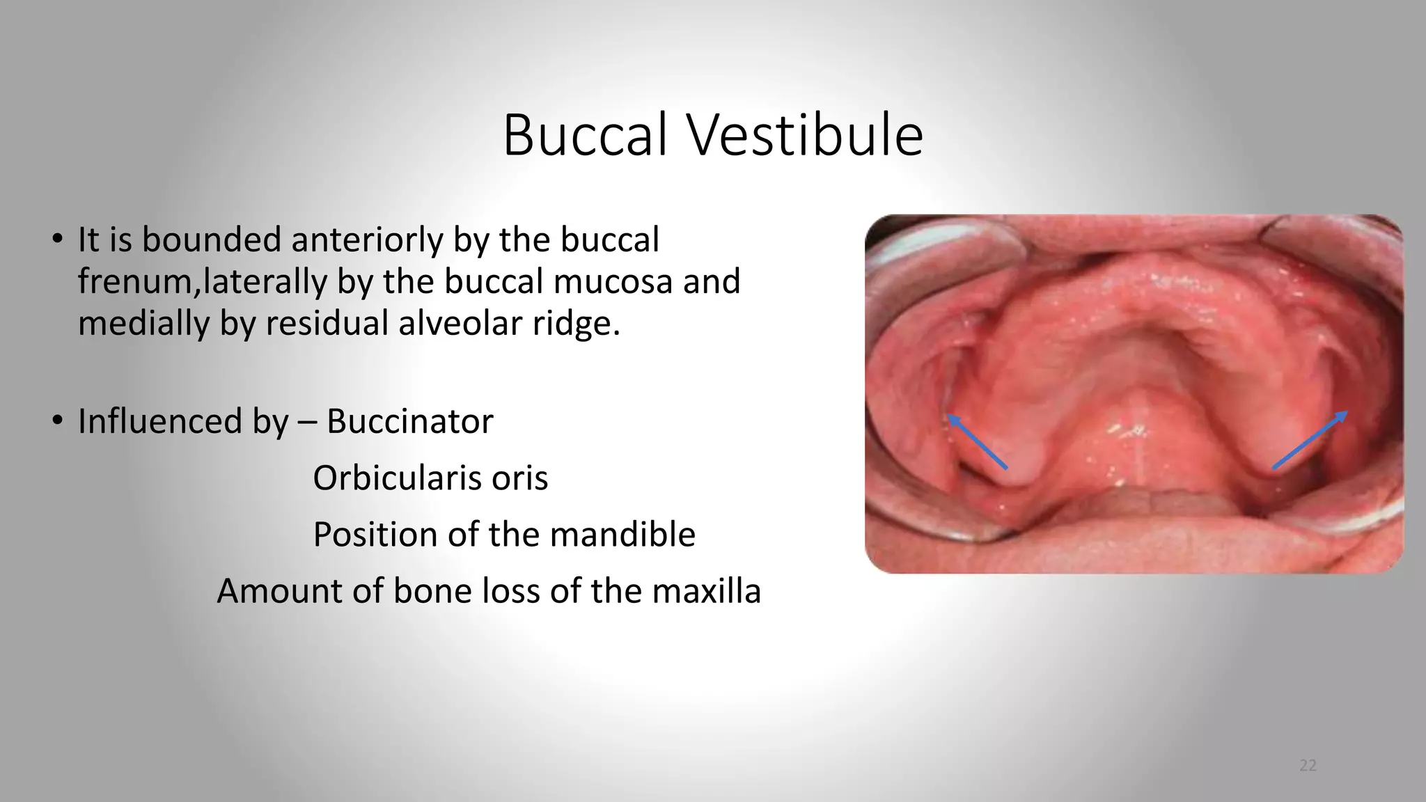 Anatomical landmarks of maxilla | PPTX