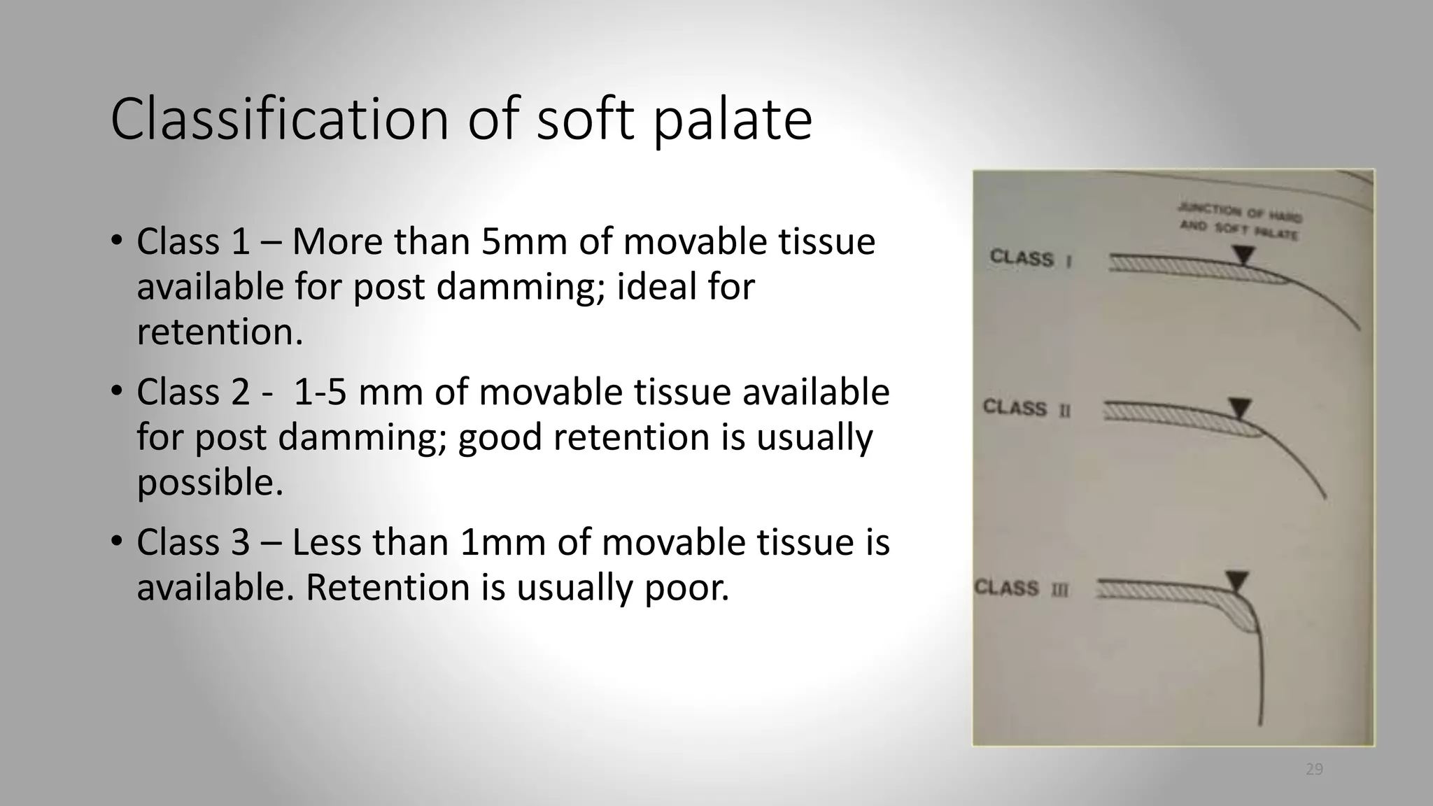 Anatomical landmarks of maxilla | PPTX
