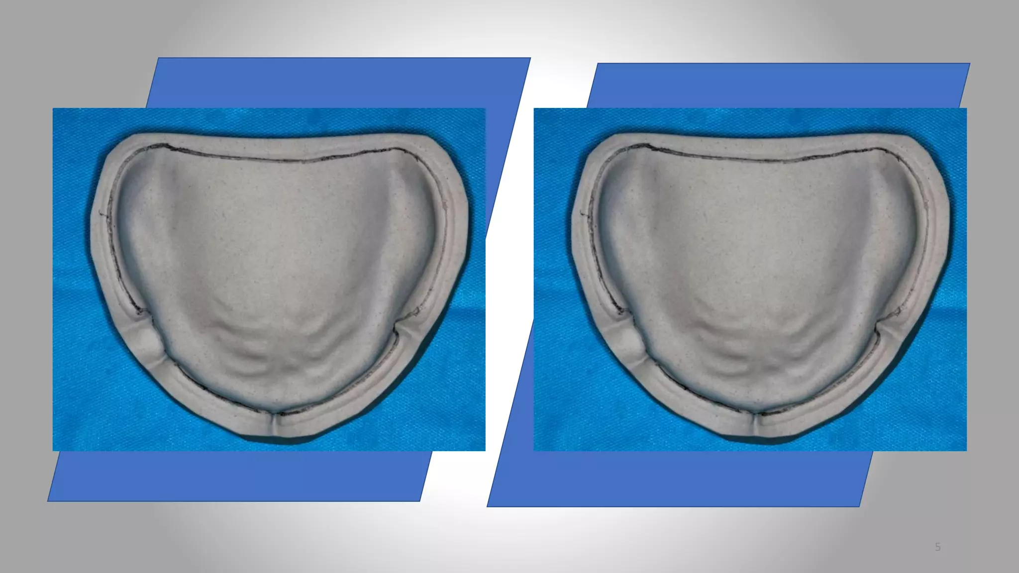 Anatomical landmarks of maxilla | PPTX