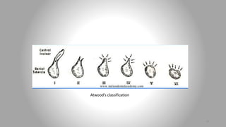 Anatomical landmarks of maxilla | PPTX