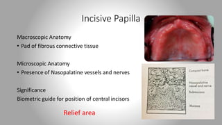 Anatomical landmarks of maxilla | PPTX