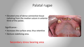 Anatomical landmarks of maxilla | PPTX