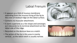 Anatomical landmarks of maxilla | PPTX